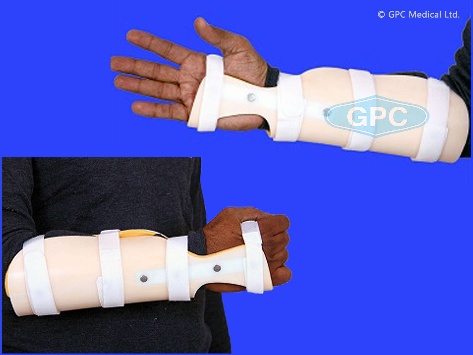 Forearm Splint
